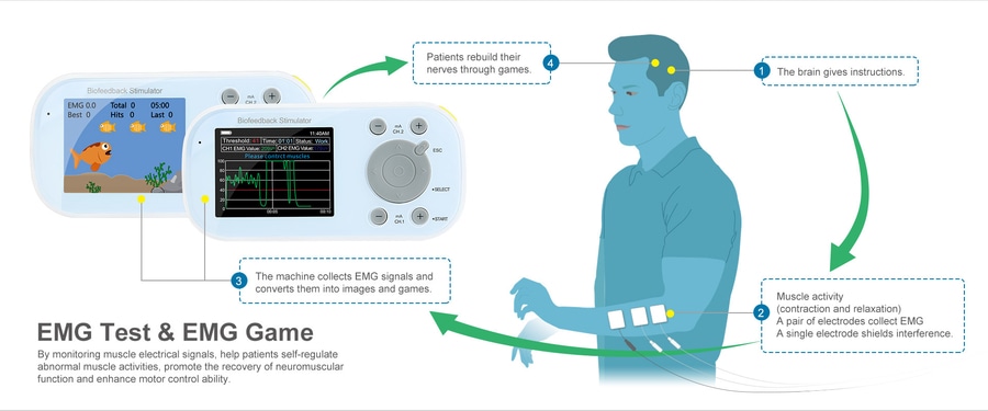 What is EMG TEST and EMG Game? - Shenzhen, Guangdong Province, China ...