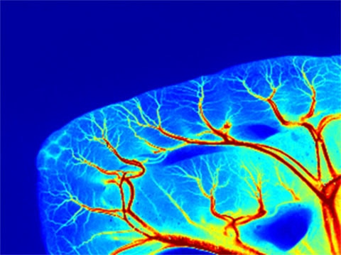 New Product| RFLSI ZW Laser Speckle Contrast Imaging System – An ...
