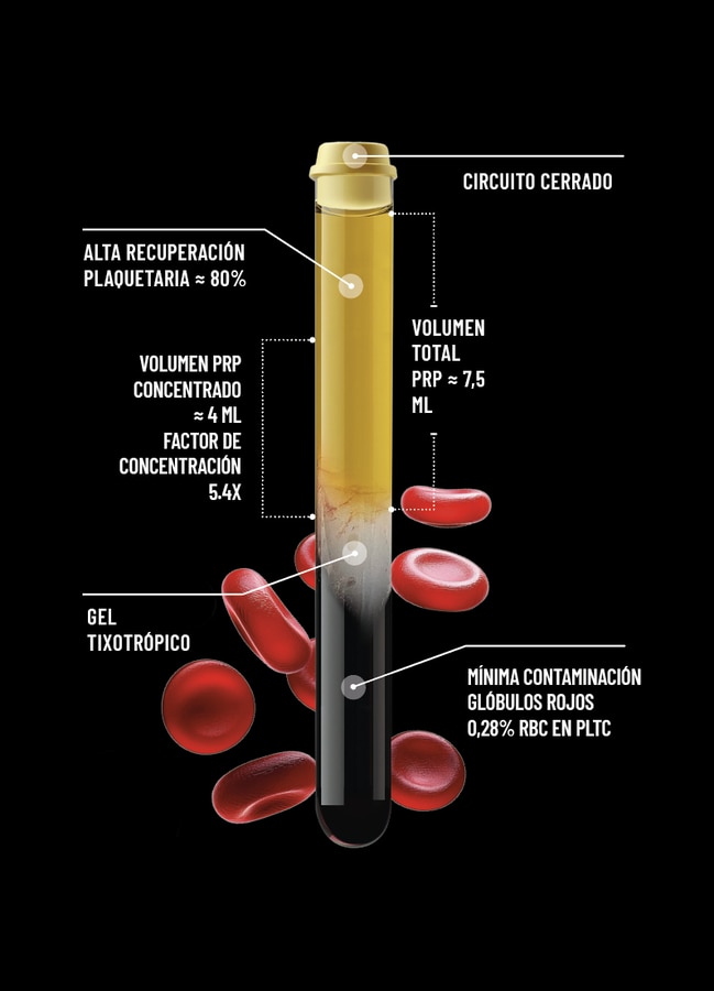 SBL.PRP.3 Kit for the preparation of platelet-rich plasma and growth ...