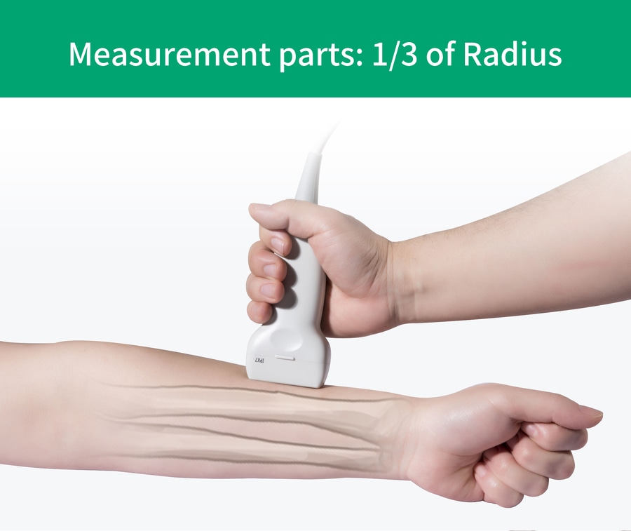 Ultrasound bone density examination: A rapid and radiation-free ...