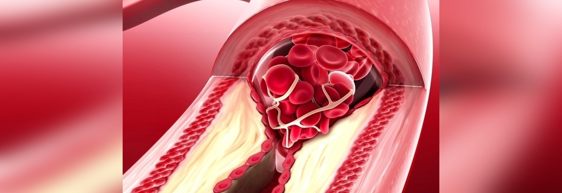 Significance of the “arterial stiffness” measurement - Budapest ...