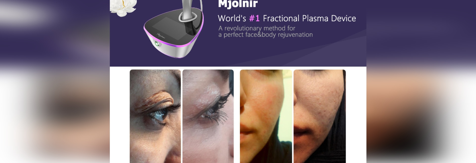 The First Fractional Plasma Device in the World - MjoInir - Shenzhen ...