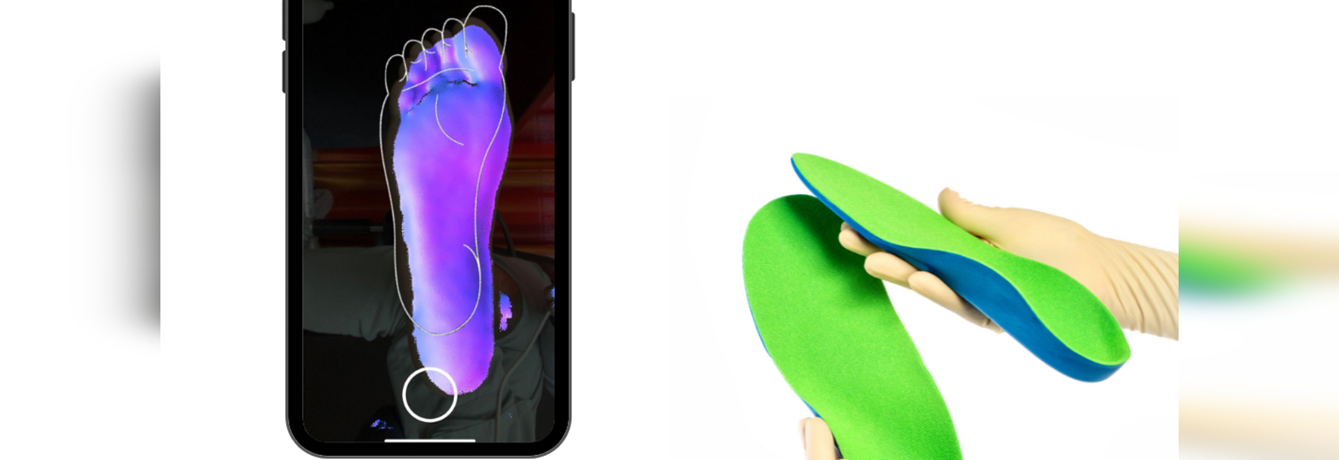 ReTiSense LIDAR-Based Scanning System for High-Precision Custom ...