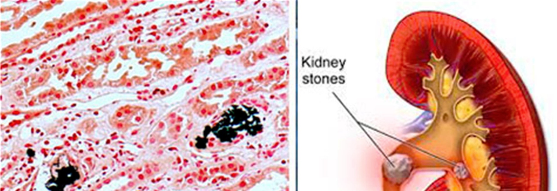 Launch of Oxalate - Barcelona, Barcelona, Spain - BioSystems S.A.