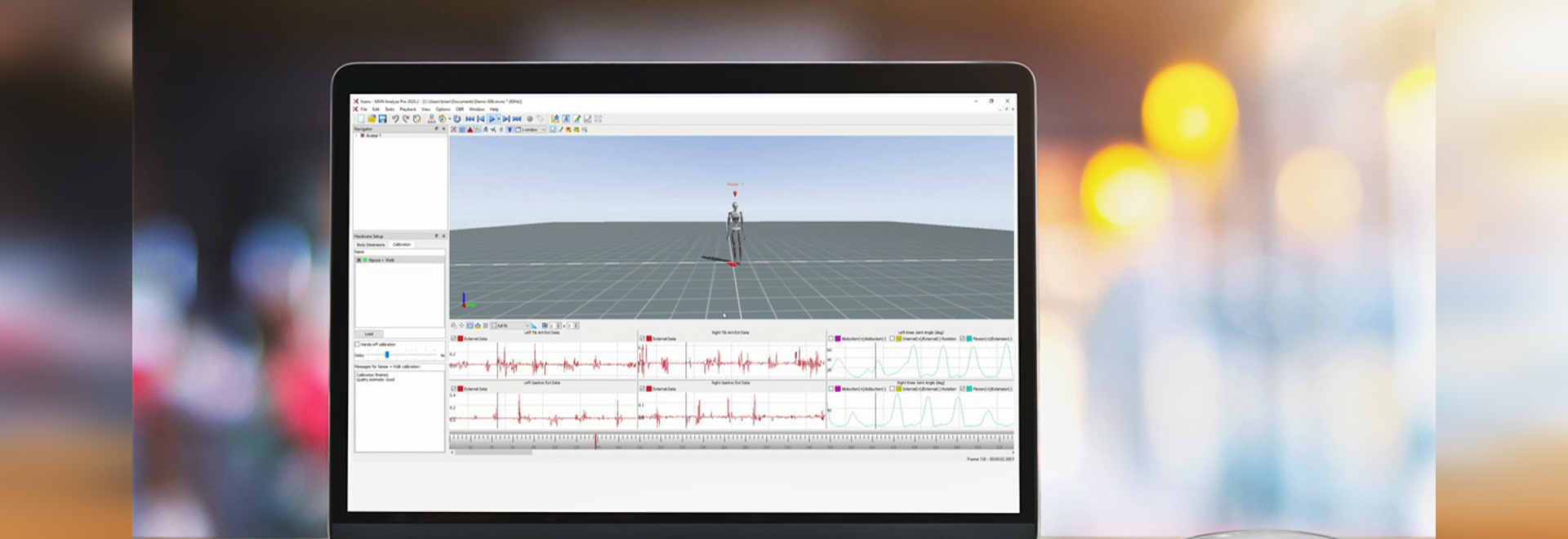New Delsys Trigno & Xsens MVN Integrated Platform - 23 Strathmore Rd ...