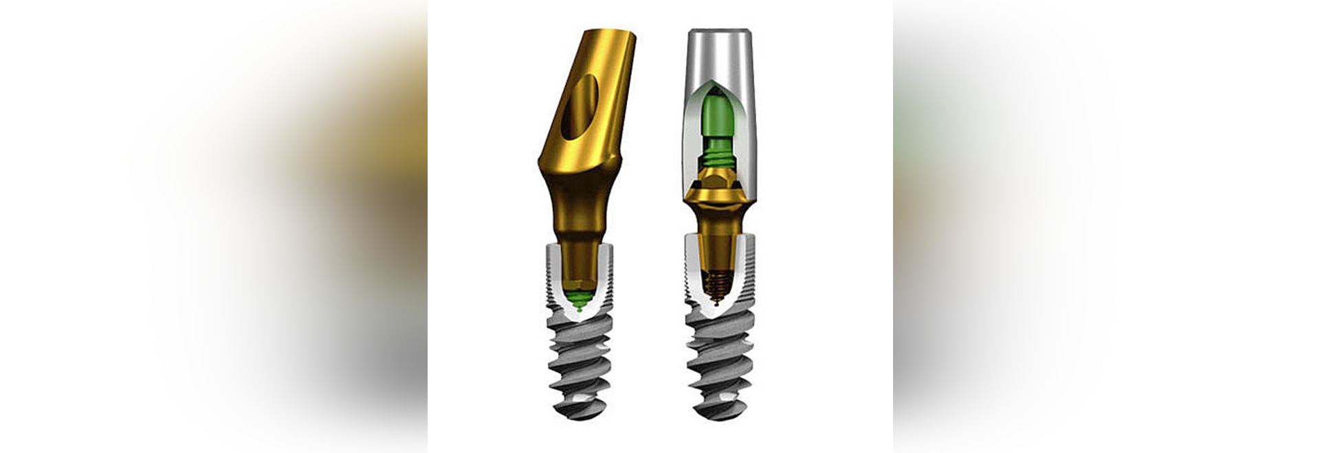 New generation of two-component implants ROOTT - TRATE AG