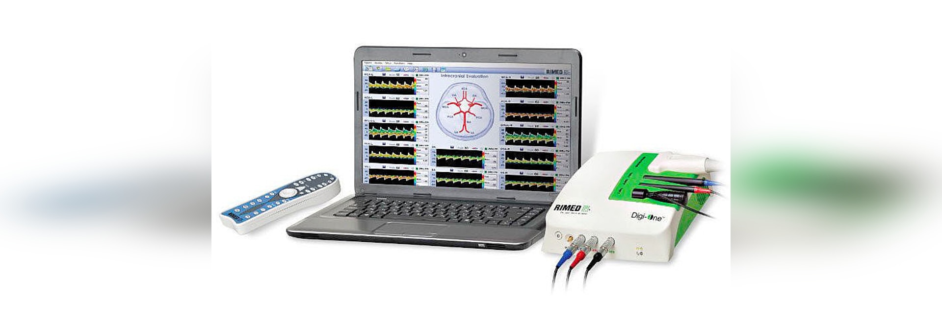 Rimed is proud to present its 7th generation TCD product : Digi-One ...