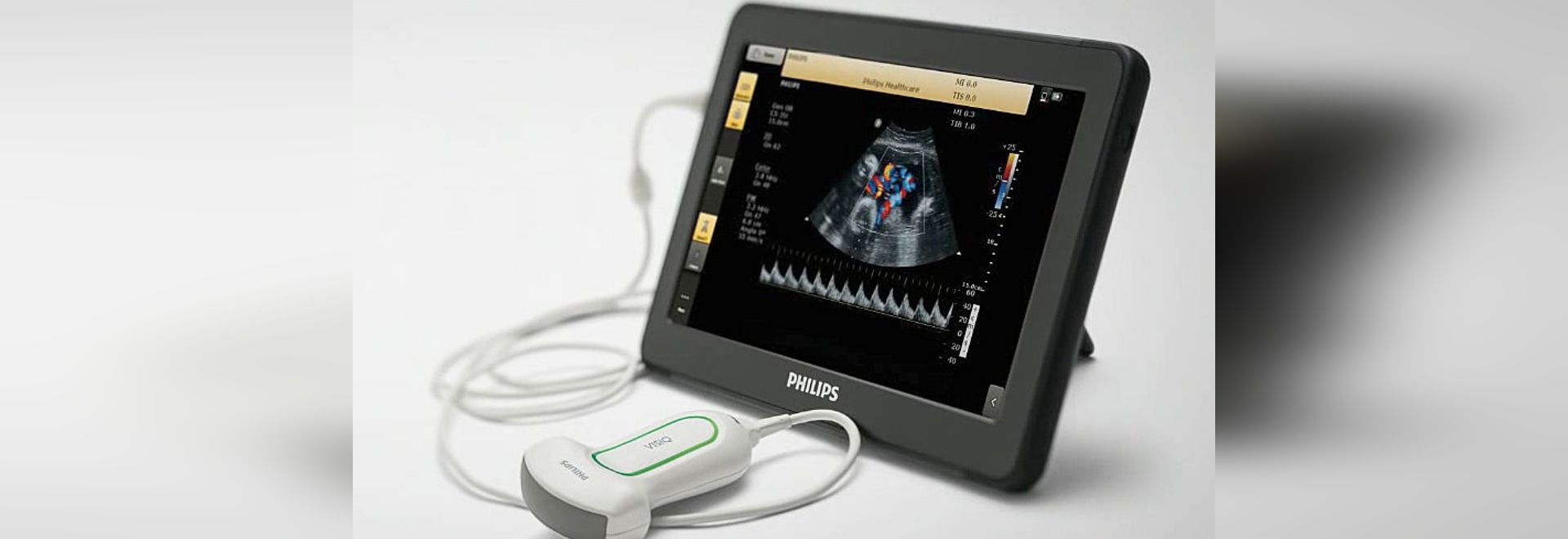 VISIQ by Philps - Not just a new ultrasound, a new vision - Philips ...