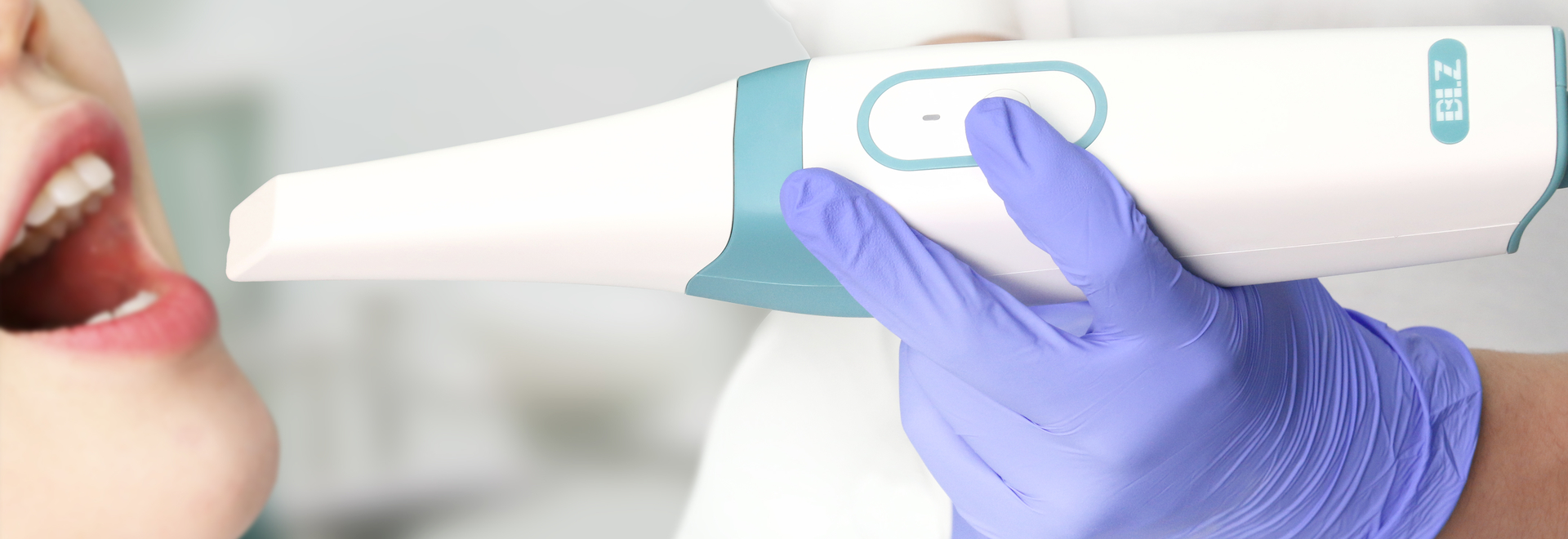 What the best intraoral scanners refer to? - Wuhan, Hubei, China - BLZ ...