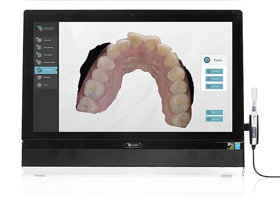 Condor : The World’s Most Innovative Intra-oral Impression Scanner - Condor
