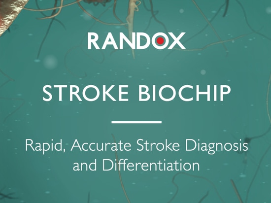 Introducing the Randox Stroke Biochip - 55 The Diamond Rd, Crumlin BT29 ...