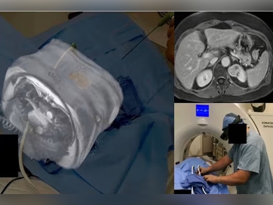 Revolutionizing Medical Training: AI Integration with True Phantom Solutions' Advanced Phantoms ...