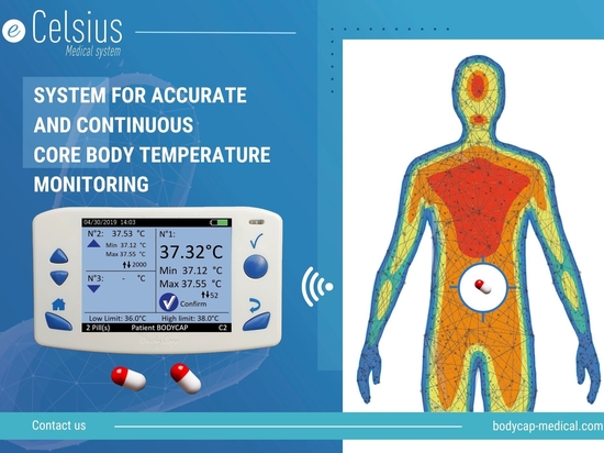 Core body temperature monitoring system - eCelsius Medical system - 3 ...