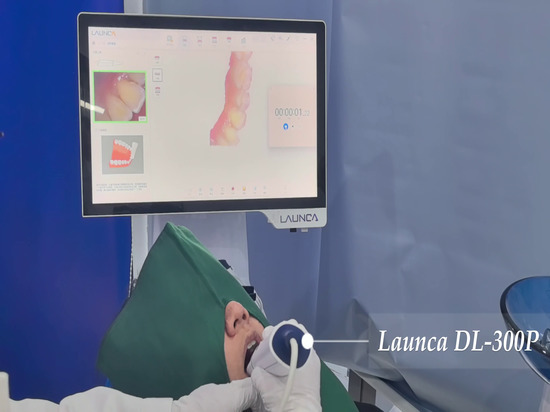 Launca DL-300 Intraoral Scanner: Achieve Full Arch Scans in just 10 ...
