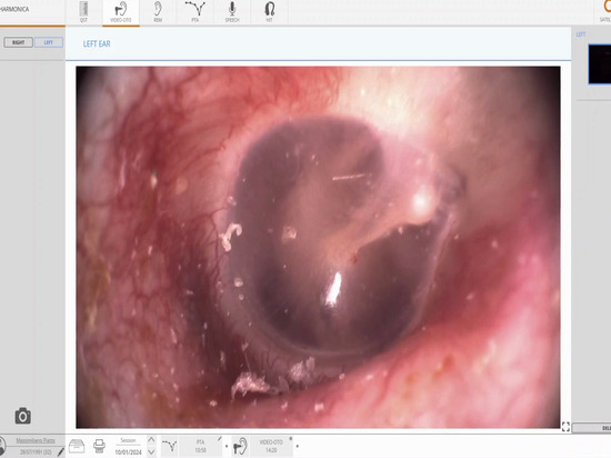 Unveiling Inventis Harmonica: A Revolution in Ear Examinations - Corso ...