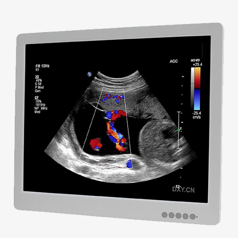 超音波画像診断用モニター - Reshin Monitors - 1920 x 1080 / 15インチ / LCD