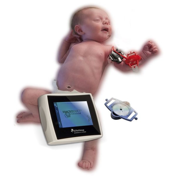 新生児用嚢胞性線維症分析器 - Macroduct® - ELITech Group - 汗試験