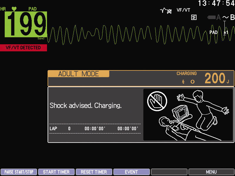 半自動外部除細動器 / Bluetooth / 二相性 / マルチパラメータ モニター付 - TEC-8300 series - Nihon ...
