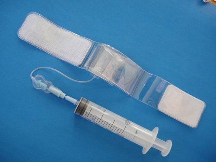 橈骨動脈止血器 - Premofix® Sunmed Radiseal - Orthobroker