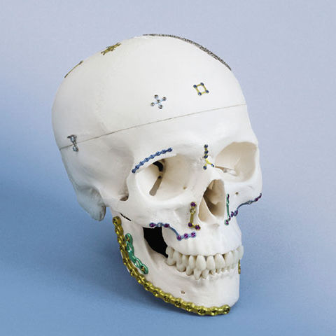 下顎骨用圧迫プレート - OPTIMUS - OSTEONIC - ロッキング / ノンロッキング / 金属製