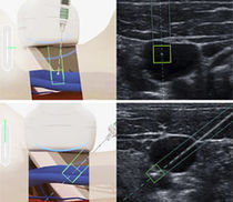 EZono :医用画像 - MedicalExpo