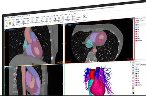 ビューアソフト - Mimics - Materialise UK - 医療用 / 診療所用 / 管理用