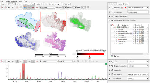 質量分析法用ソフト - SCiLS lab - Bruker Daltonics Inc./ブルカー - 分析 / 可視化 / 解析