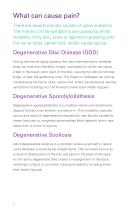 ALIF - NuVasive - PDF Catalogs | Technical Documentation