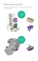 ALIF - NuVasive - PDF Catalogs | Technical Documentation