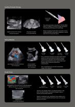 bkSpecto - BK Ultrasound - PDF Catalogs | Technical Documentation