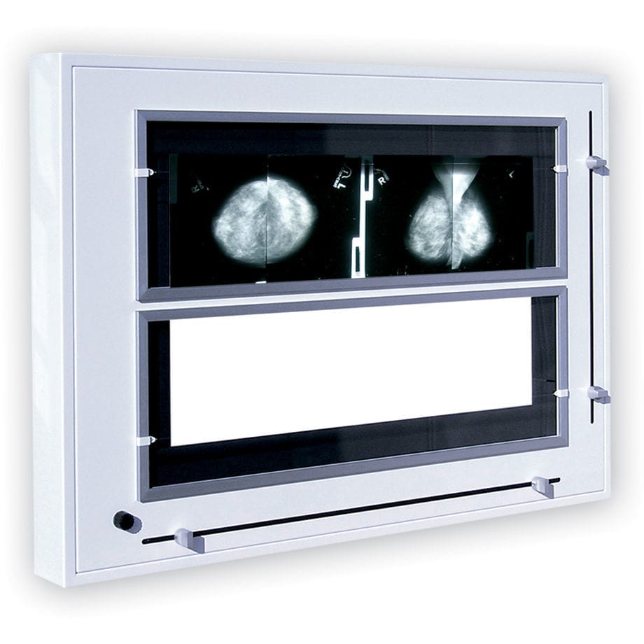 Negatoscópio 2 corpos - Rego X-ray - de luz branca / para mamografia