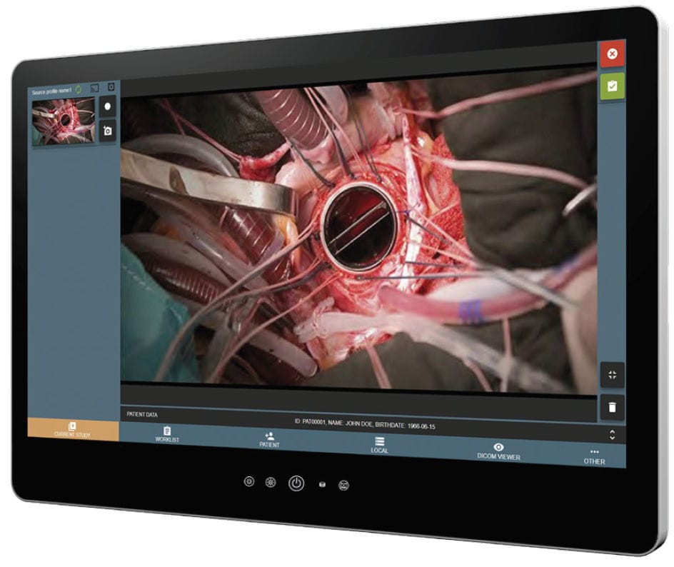 Software de gravação de vídeo - MEDDREAM - SOFTNETA Medical Imaging ...
