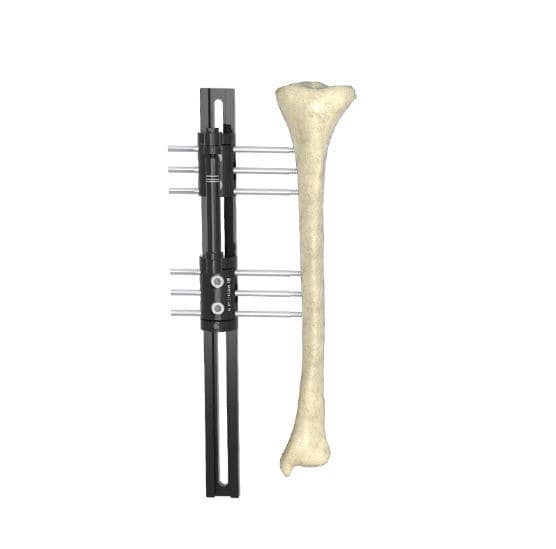 Fixador externo modular - Wuxi Betta Medical Technology - tubular