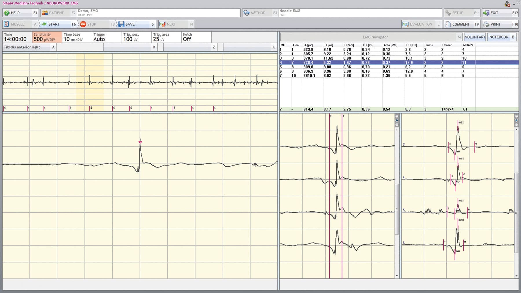 Software para EEG - NEUROWERK® - Micromed - para EMG / de gestão de ...
