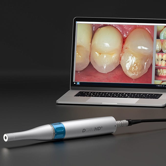 Câmera intraoral - D-CAM HDS - I.C. LERCHER - analógica / HD / 2560 x 1920
