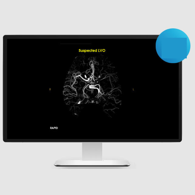 Software para diagnóstico de AVC - LVO - RapidAI - de validação ...
