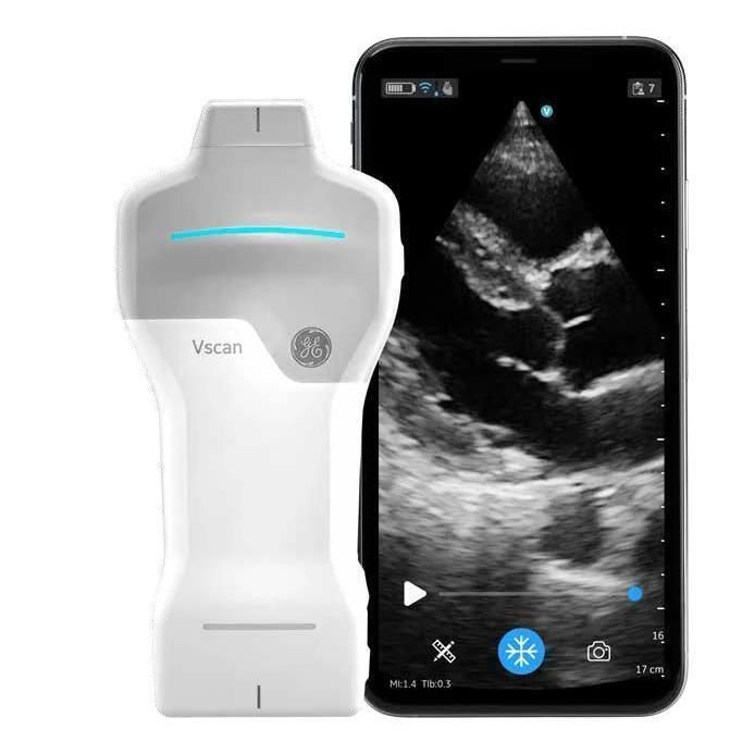 Aparelho de ultrassom portátil - Optip Probe - Predict S.p.A. - geral ...