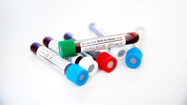 Reagente em solução - 150 series - Boule Medical - para controle de ...