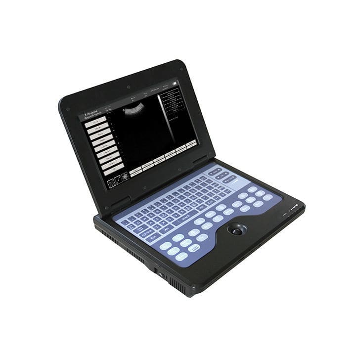 Aparelho de ultrassom portátil - CMS600P2 - Contec Medical Systems ...
