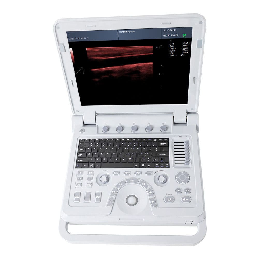 Aparelho de ultrassom portátil - CMS600P2PLUS - Contec Medical Systems ...