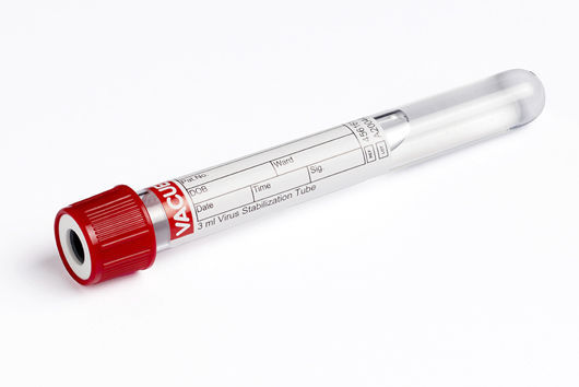 Tubo de coleta para laboratório - 456161 - Greiner Bio-One - cilíndrico ...