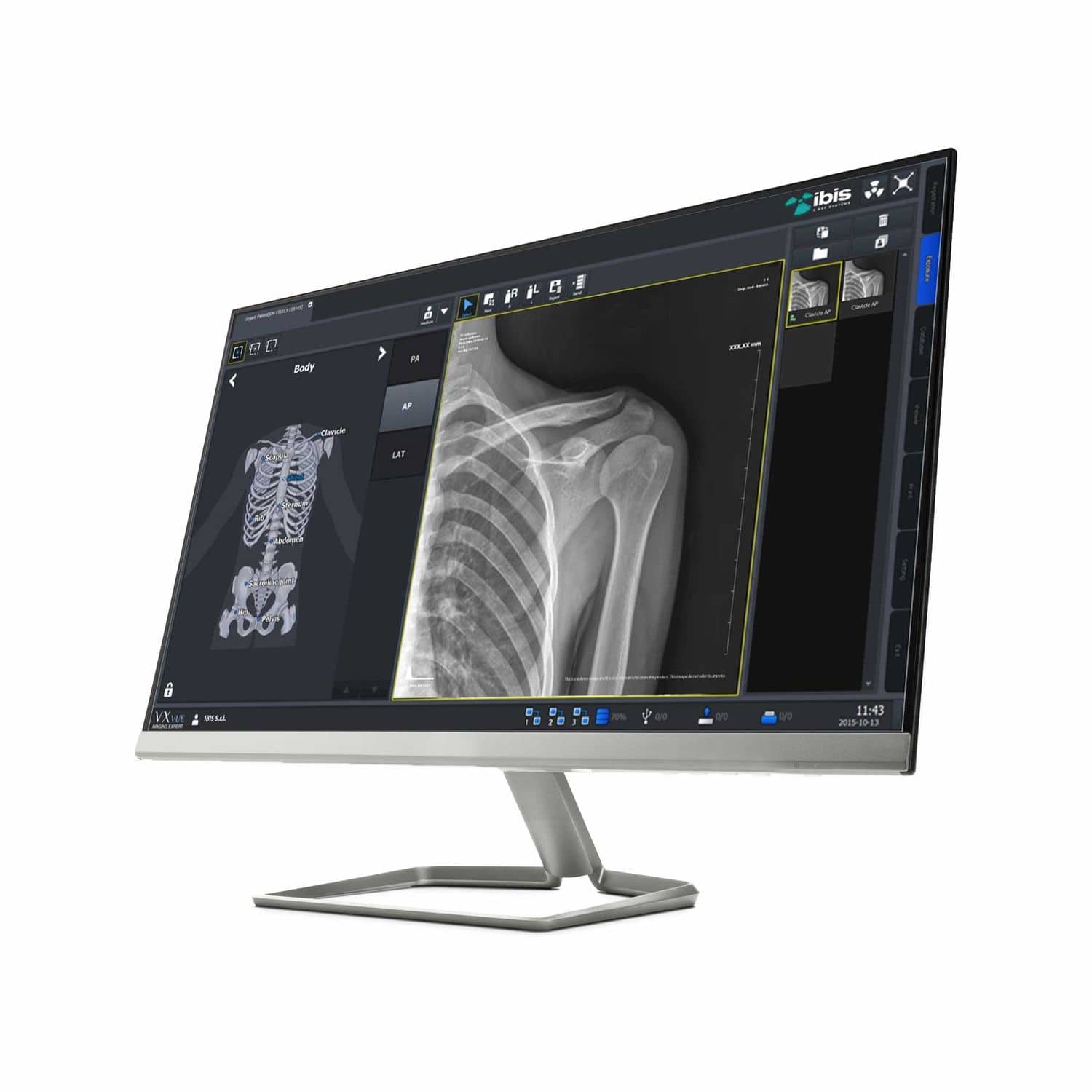 Software visualizador - IBIS X Ray Systems - para radiologia / para tablet