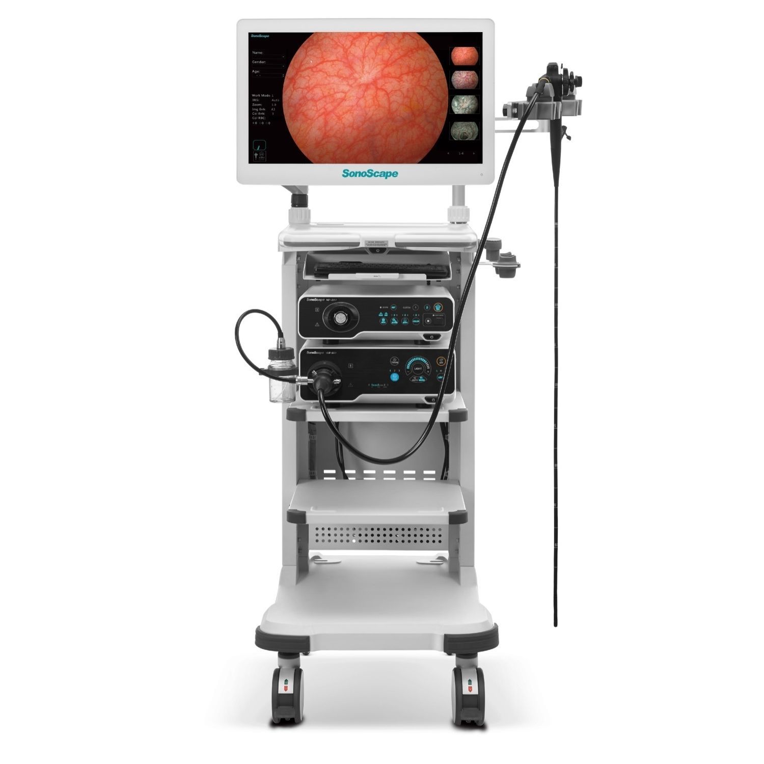 Sistema de endoscopia para broncoscopia - EB-5H20 - SonoScape