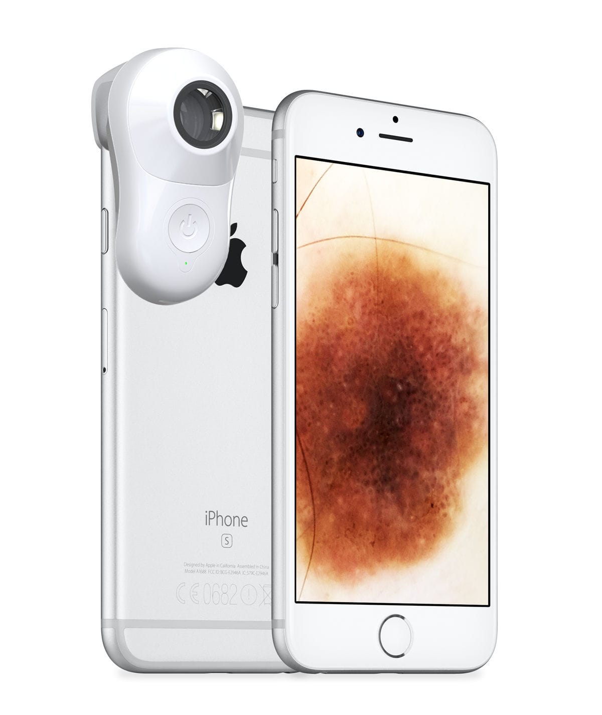 Videodermatoscópio - MoleScope II - Dino-Lite Europe - para smartphone ...