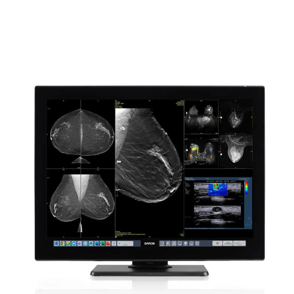 Monitor para radiologia - Coronis OneLook - Barco - para mamografia ...