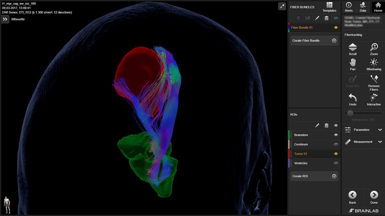 Software de análise - Elements - Brainlab - de visualização / de ...
