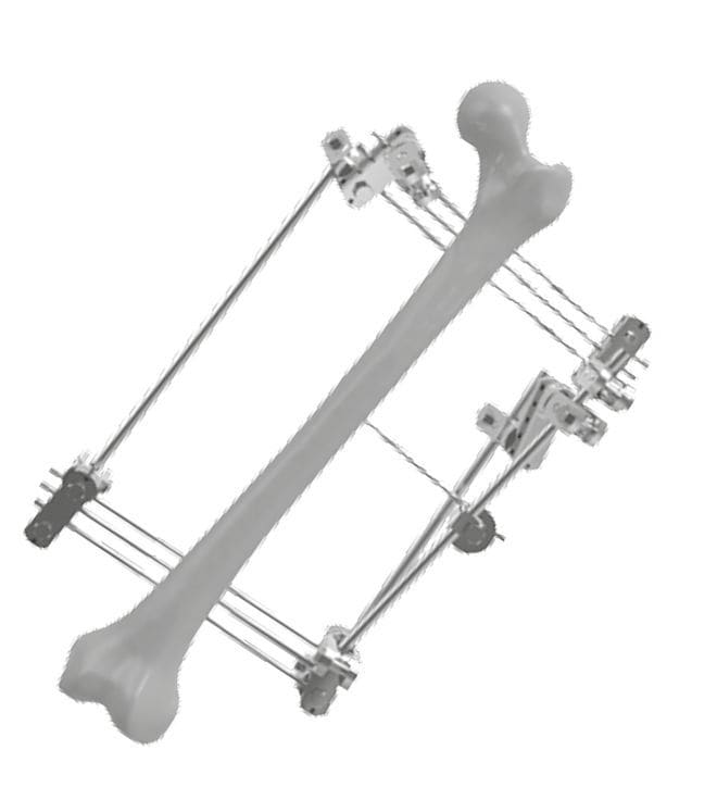 Fixador externo para fêmur - 201504 - SOFEMED International - tubular