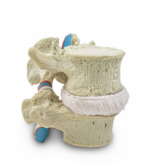 Modelo de disco intervertebral - Audible Release - Dynamic Disc Designs ...