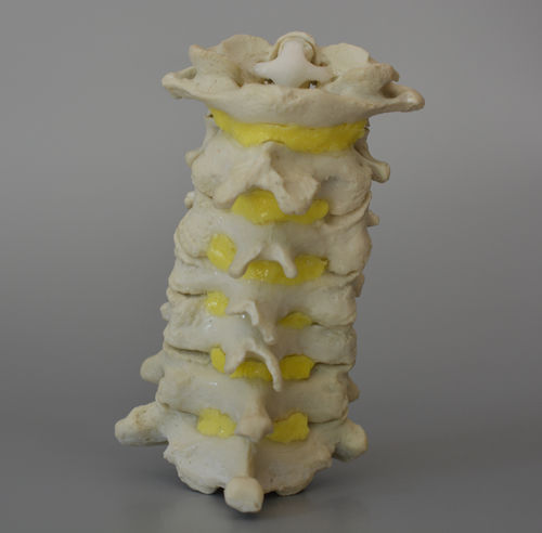 Modelo anatômico de coluna cervical - C1-7 - Dynamic Disc Designs Corp ...