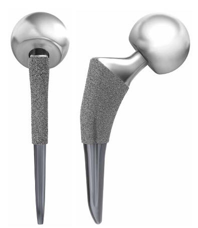 Prótese de quadril primária - Tri-Lock® - Depuy Synthes - não cimentada